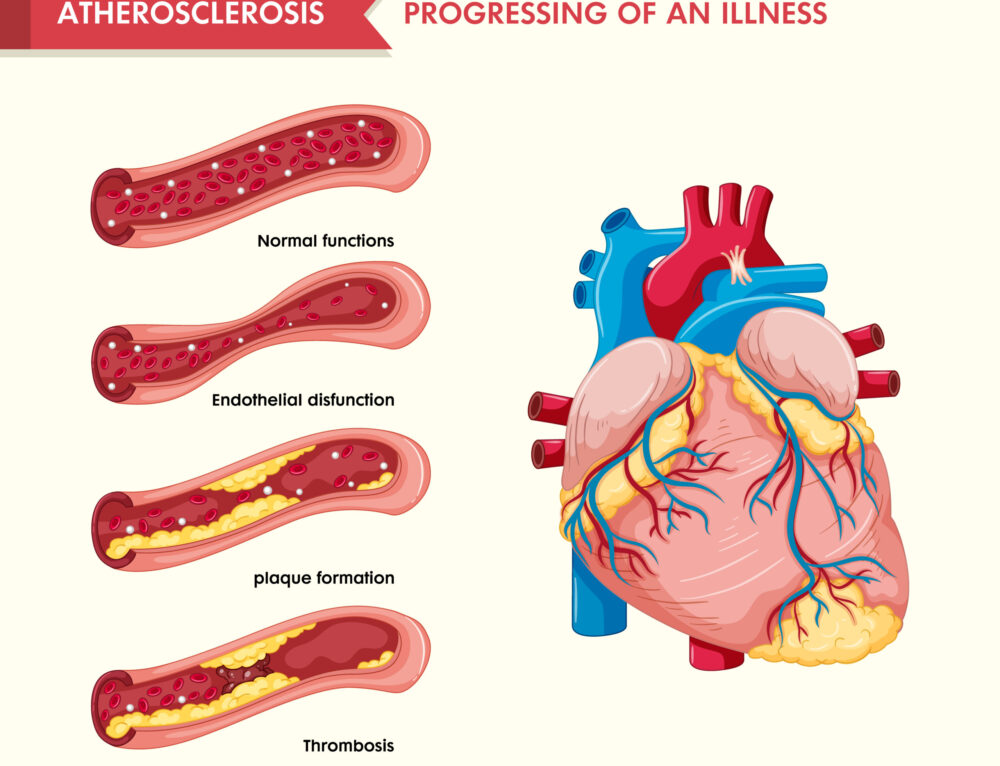 Rivoclon nedir? Rivoclon yan etkileri nelerdir?